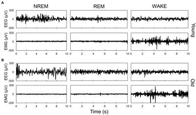 Frontiers | Analysis of circadian rhythm components in EEG/EMG data of aged mice